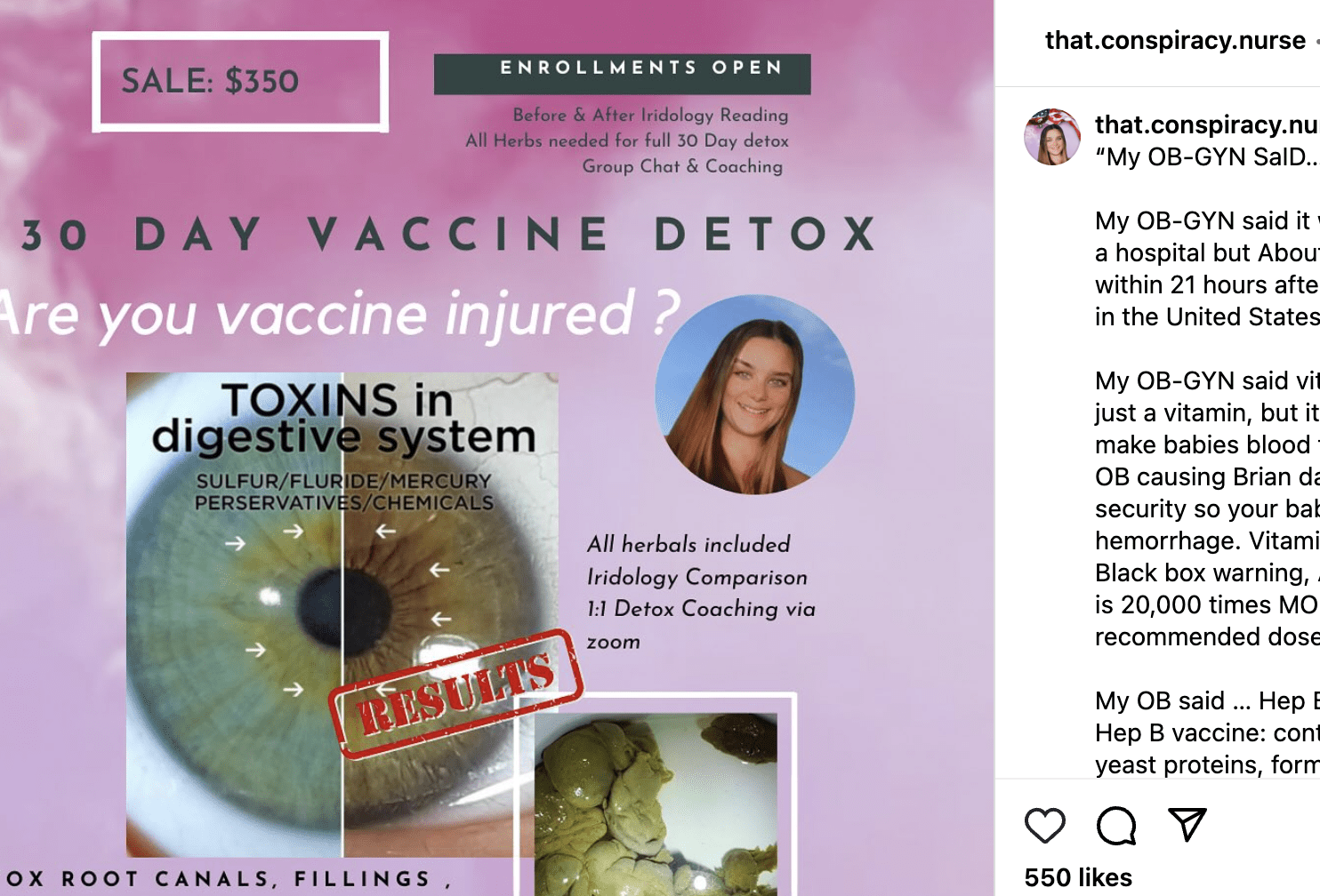 Vitamin K Shot Risks at Guillermo Brianna blog Vitamin K Shot Risks at Guillermo Brianna blog